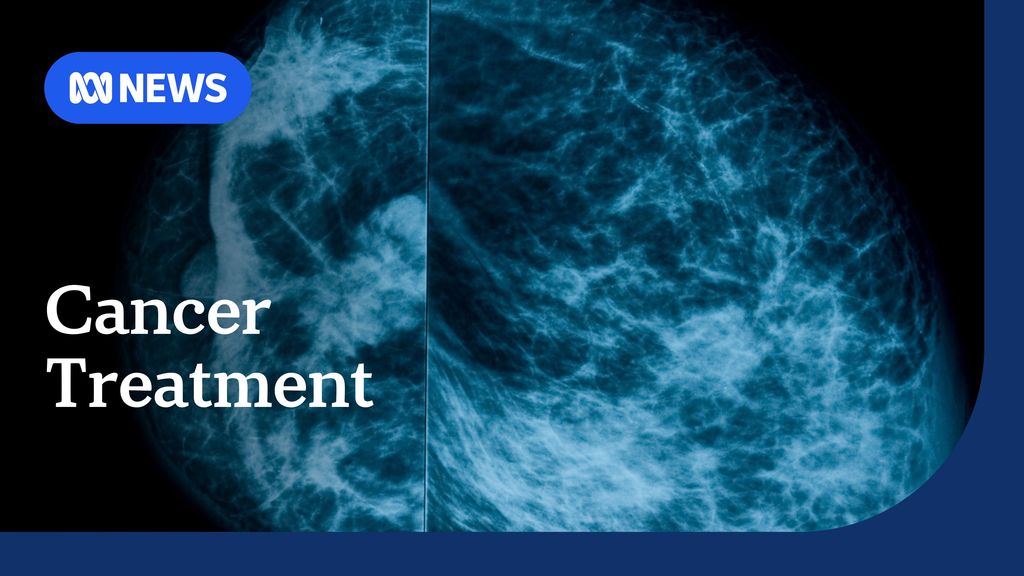 New treatments for breast and prostate cancer added to PBS - ABC News