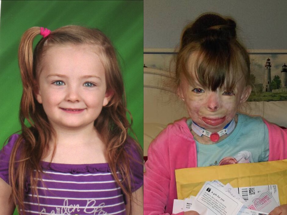 Safyre Terry, who lost family to arson, receives Christmas cards as ...