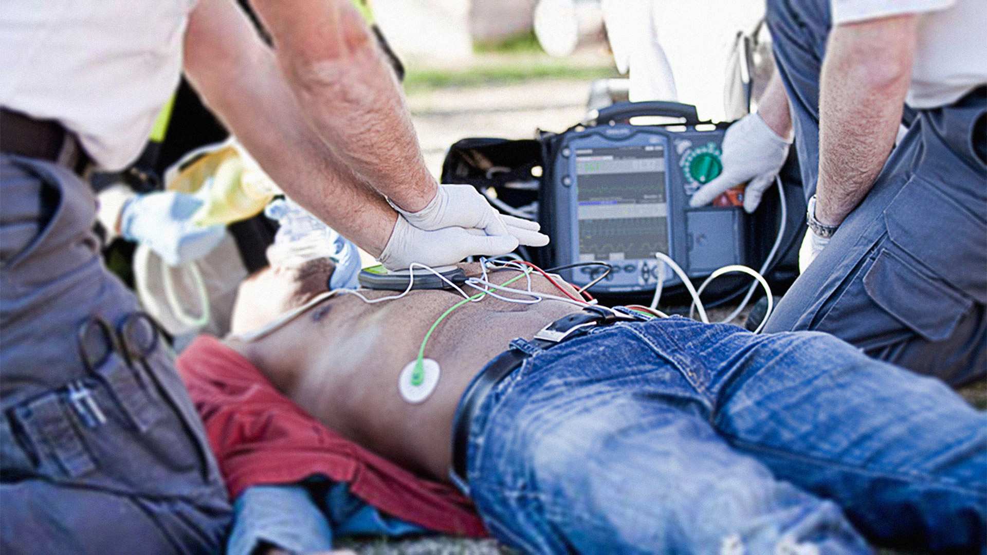 Defibrillator with fault history used in Australian ambulances - ABC listen
