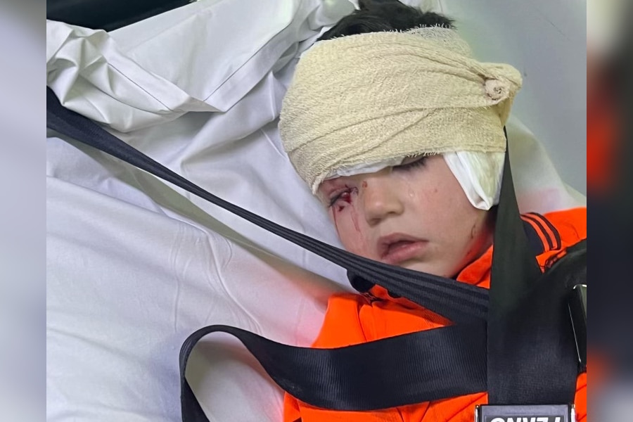 Four-year-old boy left with 'horrific' facial injuries after mauling by ...