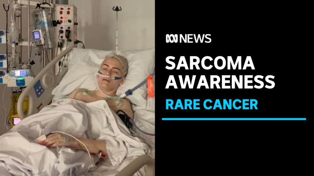 Specialists say rare cancer is often misdiagnosed - ABC News