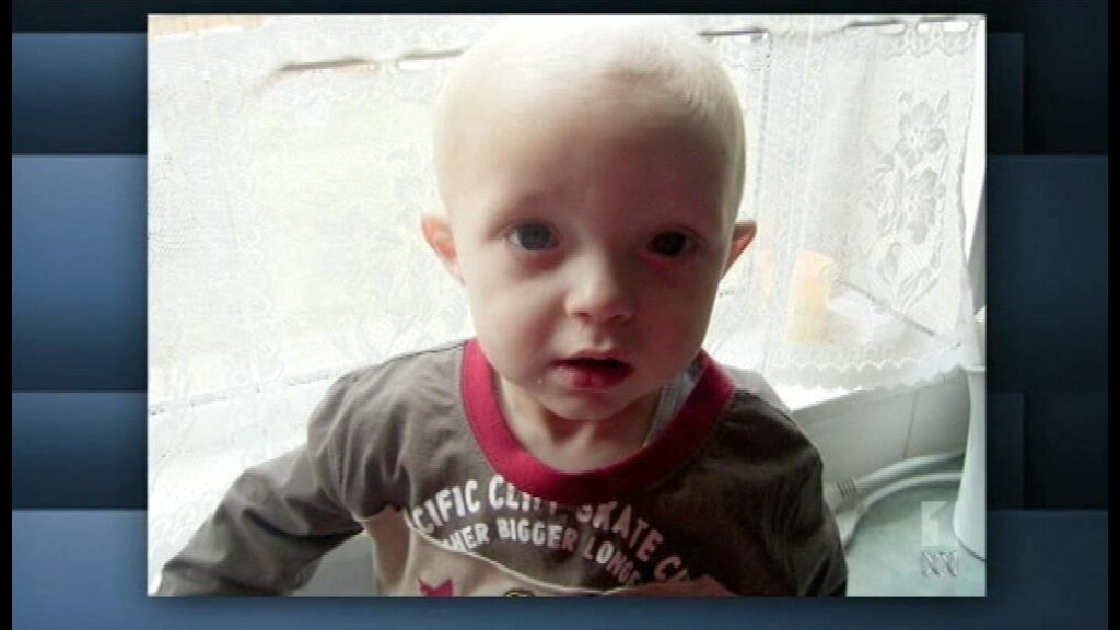 Infant autopsy reveals history of abuse - ABC News