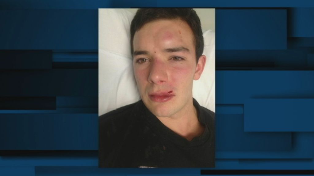 Mother of bashing victim speaks out - ABC News