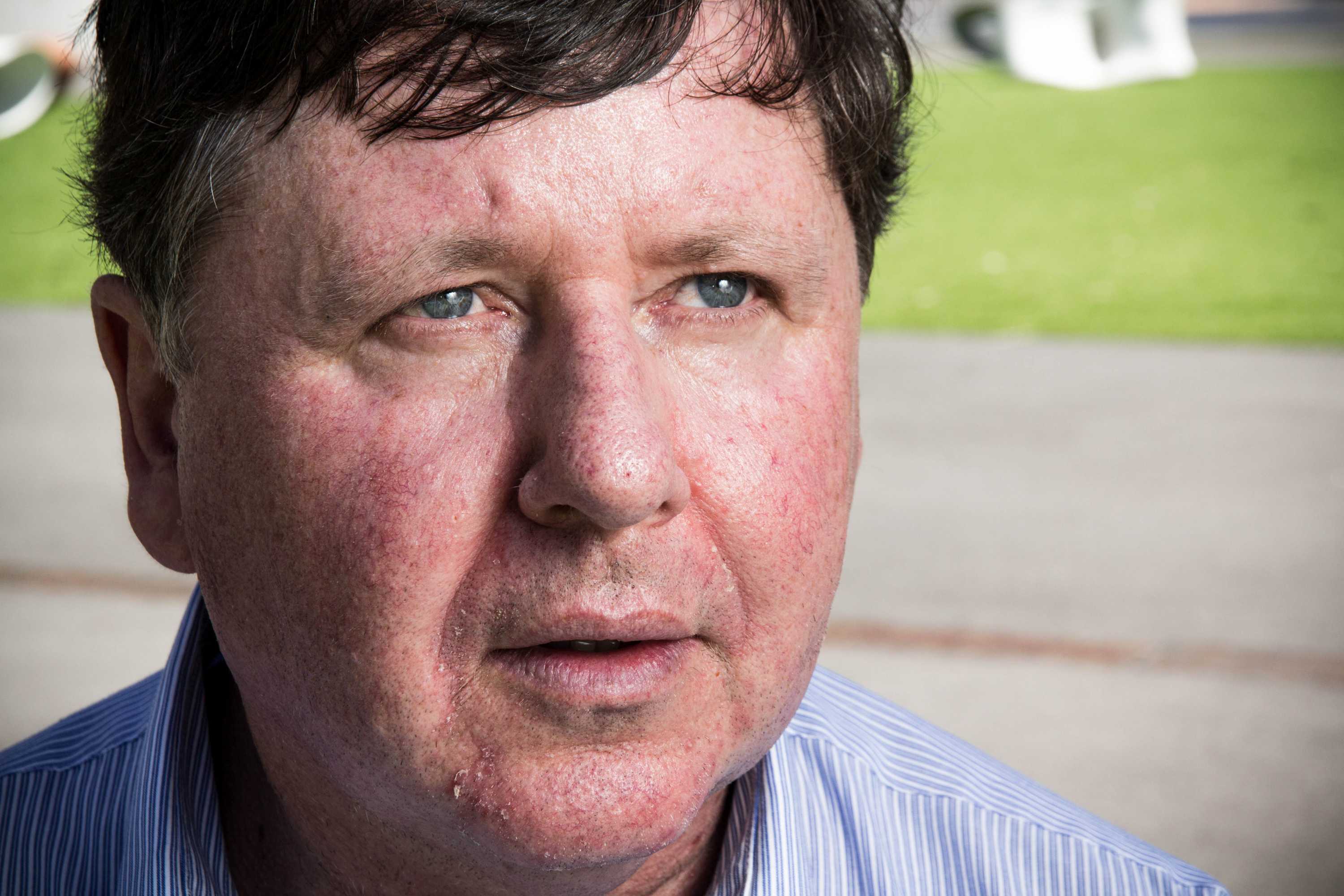 Schizophrenia education for nurses a positive outcome of Simon Swinson ...