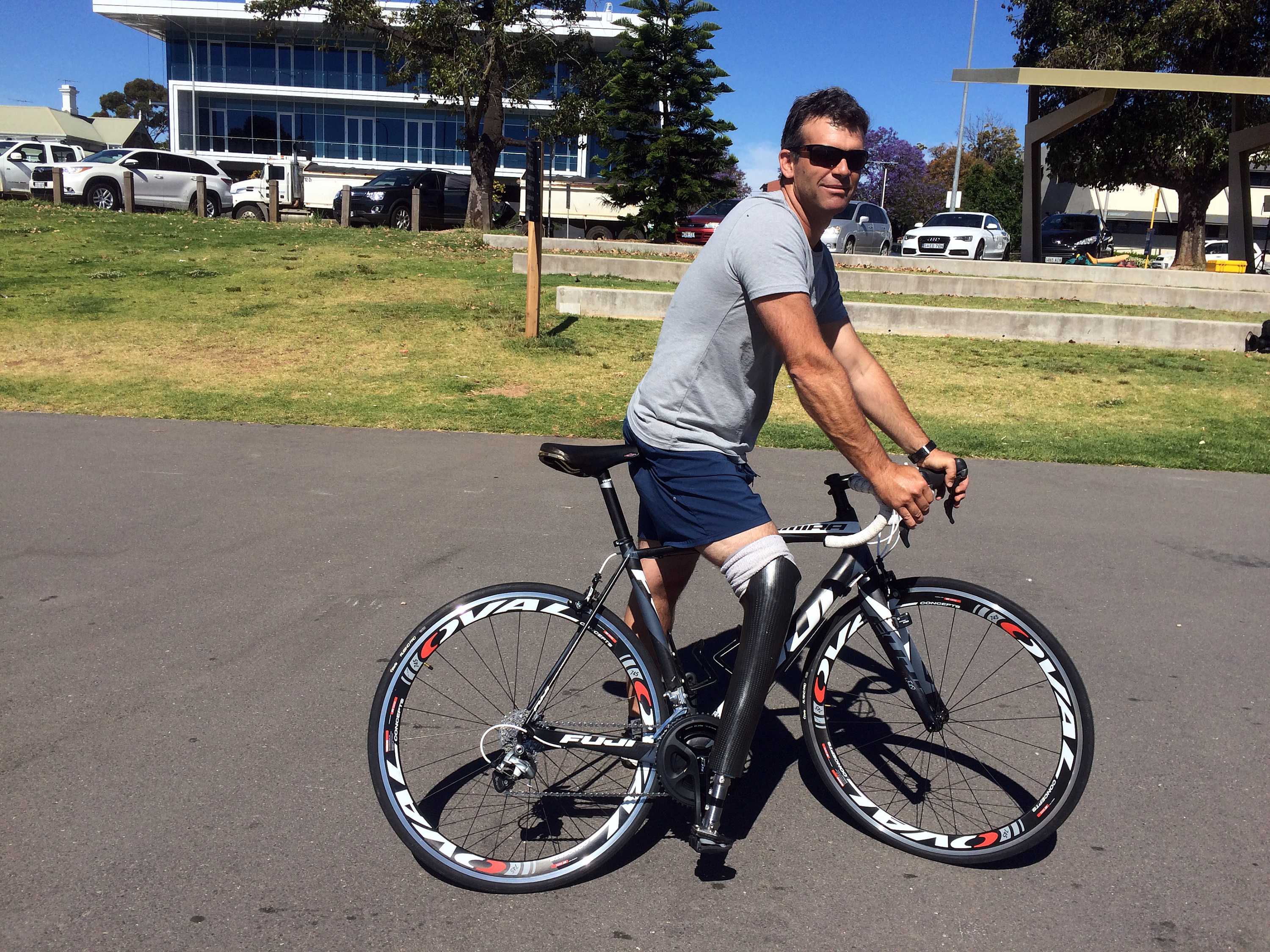 Amputee requests for prosthetics in South Australia rejected under ...