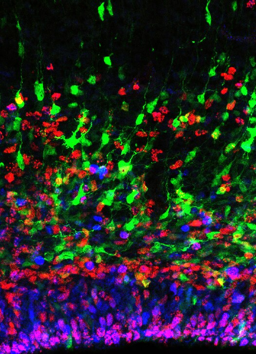 Tracking the development of nerve cells within the fetal brain - ABC listen