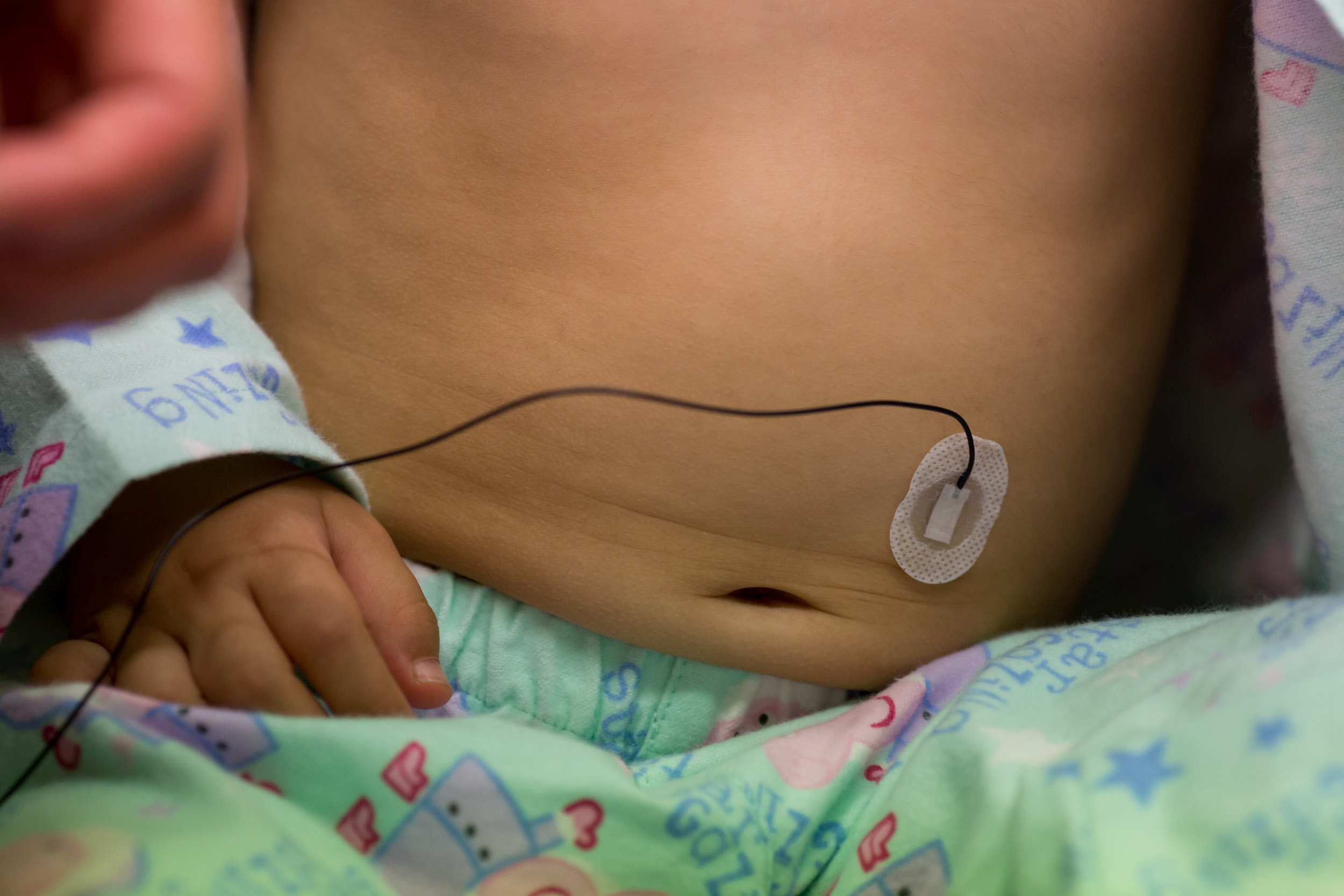 Monash Medical Centre's sleep laboratory helps kids who struggle ...