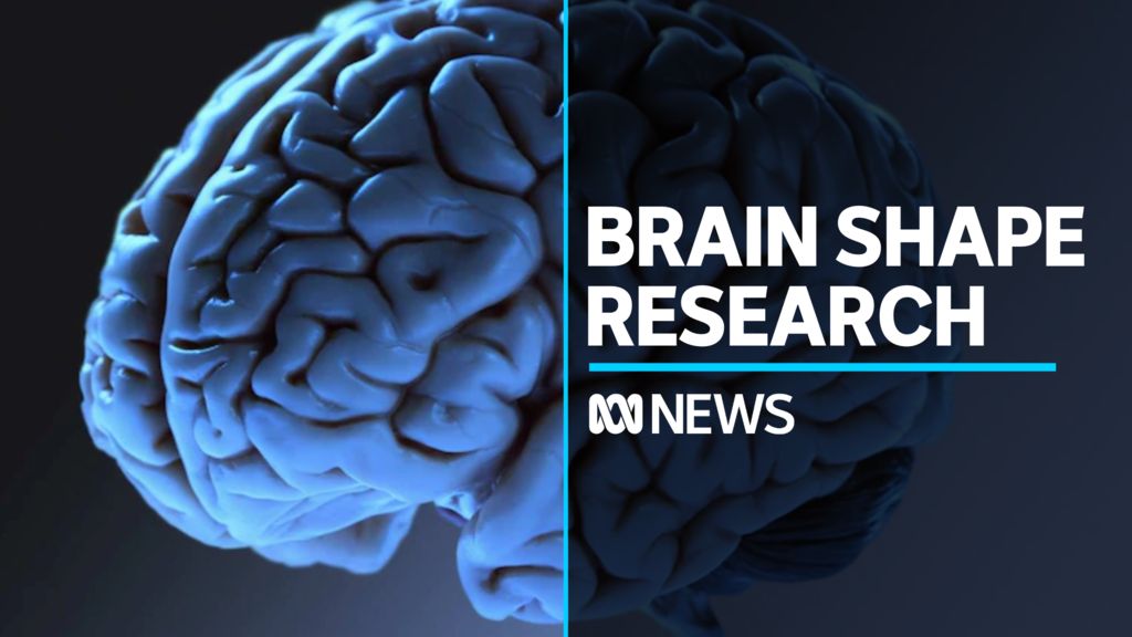 Study finds brain shape determines how we think, feel and behave - ABC News