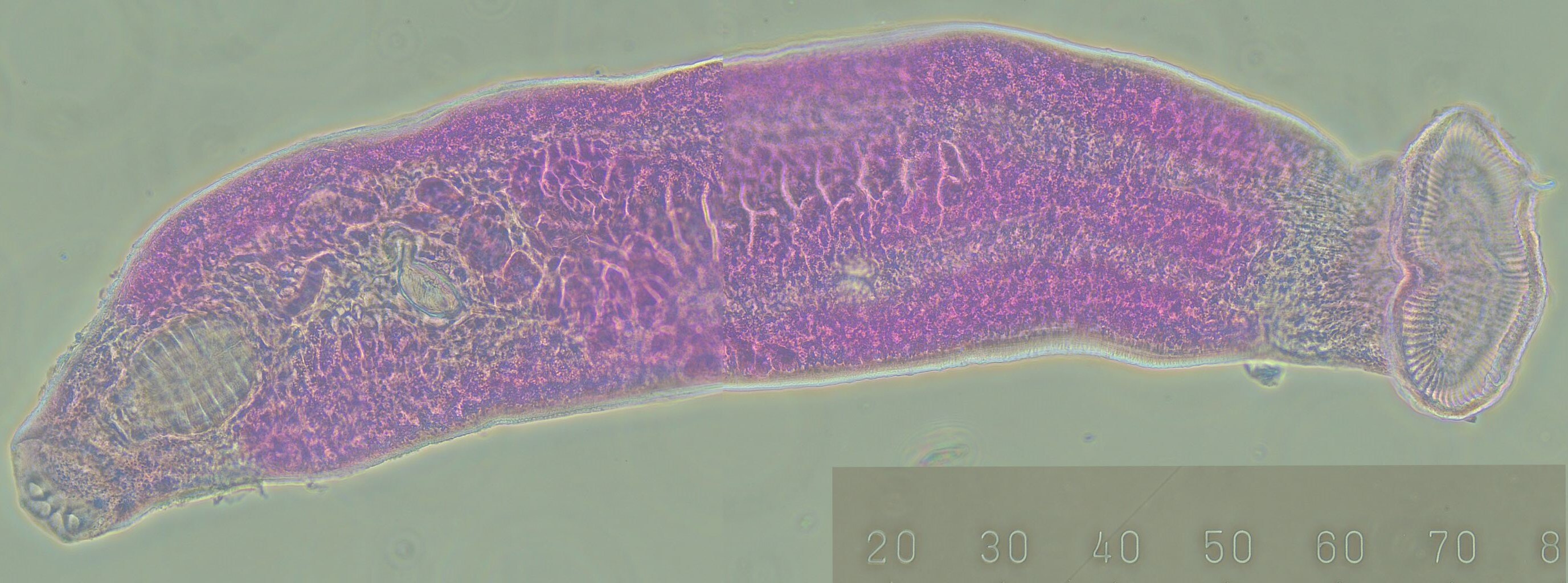 Parasitic worm, first of its kind, found on shark off central ...