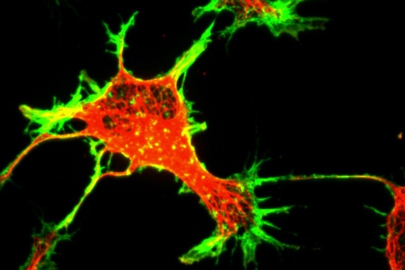 Magnetic brain stimulation trials for multiple sclerosis - ABC listen