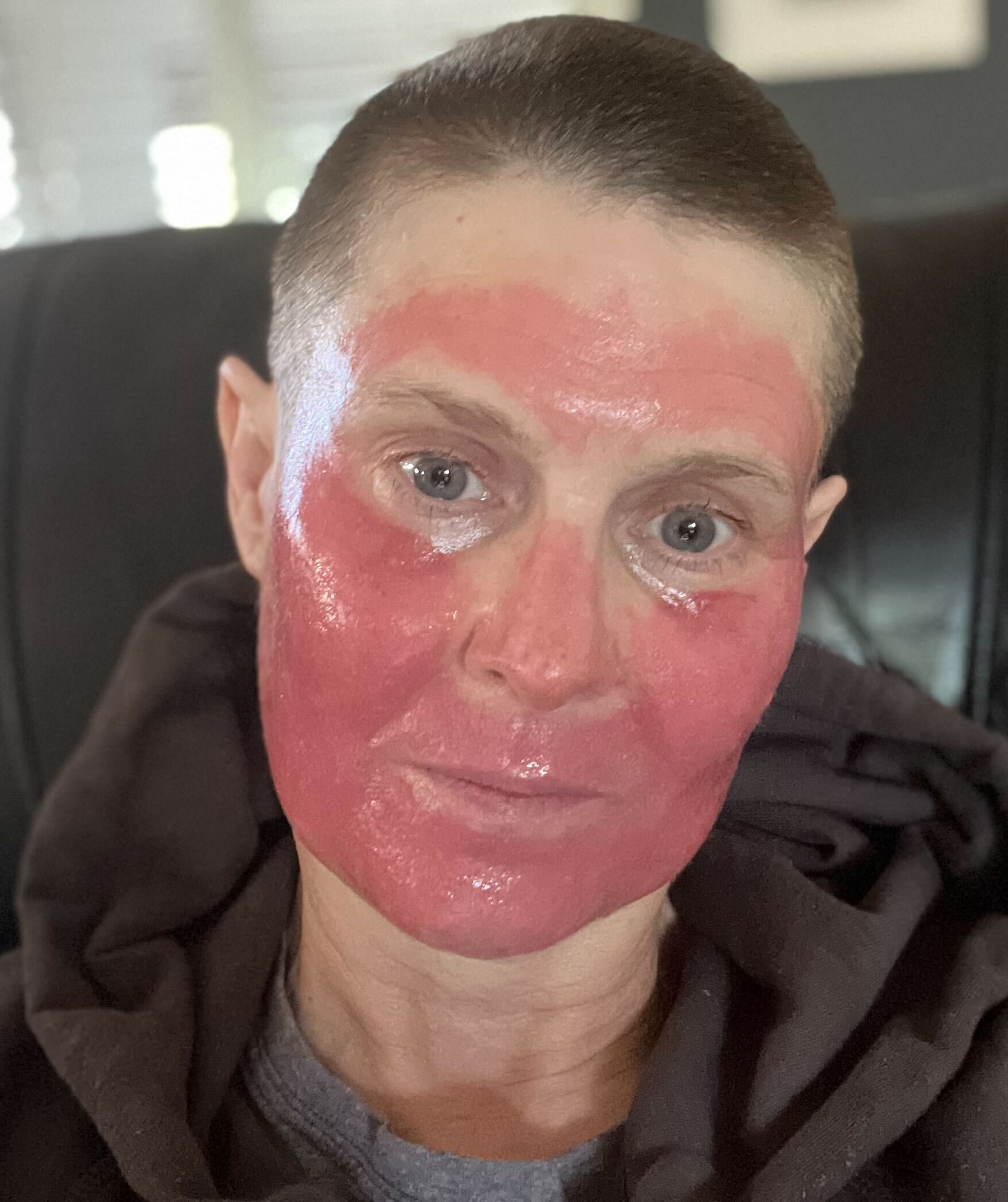 Slip Slop Slap campaign effective for Queenslanders born after 1980 as ...