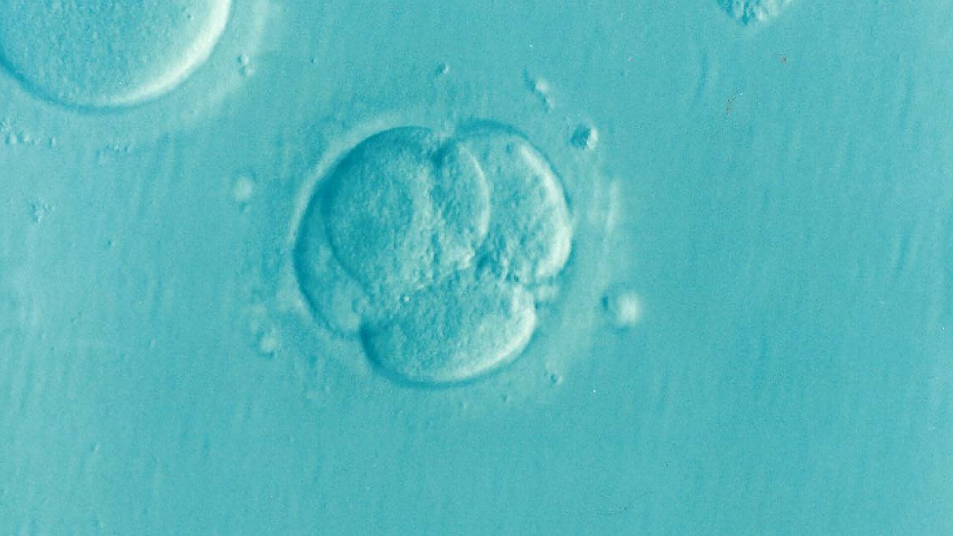 Fertility industry questioned after another embryo mix-up - ABC listen