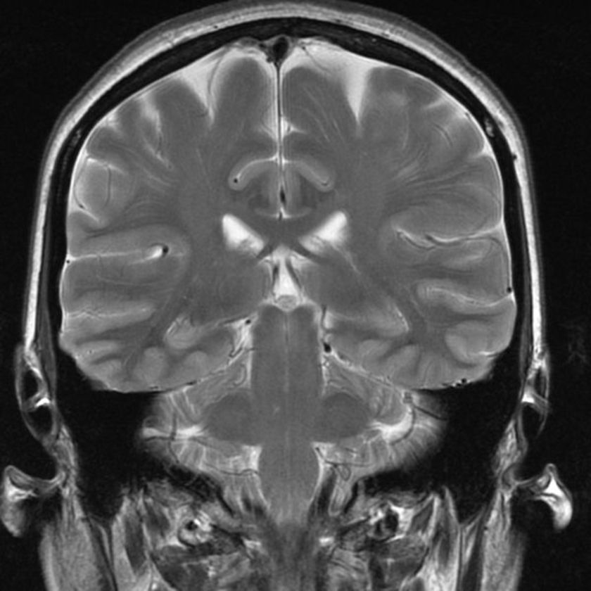 What's your earliest memory? - ABC listen