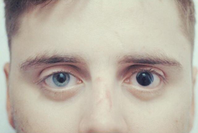 City to Bay Fun Run: Steven Deally regains vision after glassing attack ...