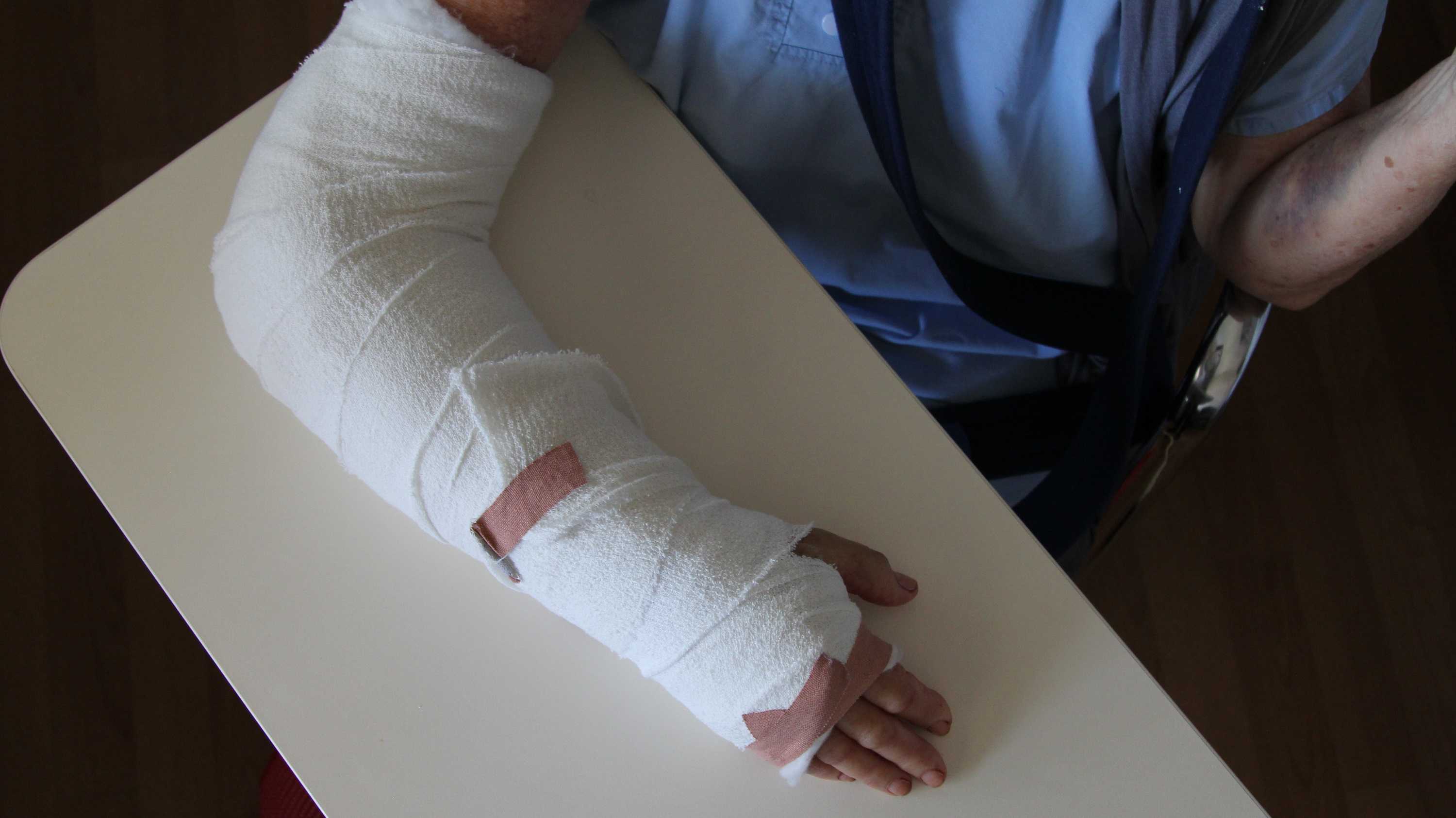 Dog that mangled woman's arm gets reprieve, prompting Palmerston ...