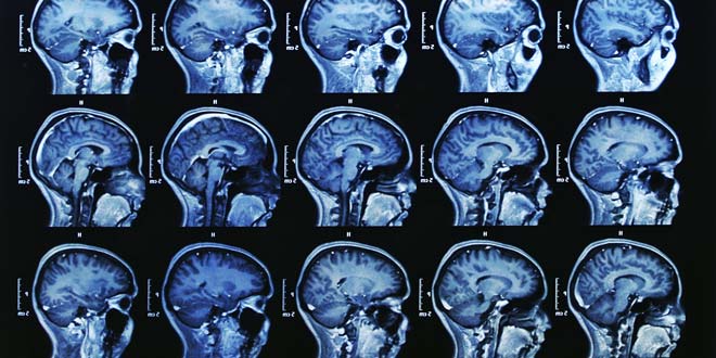 Enough of the AFL brain injuries it’s time to modify the rules ...