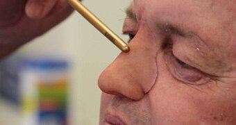 Frenchwoman Isabelle Dinoire, who received world's first face ...
