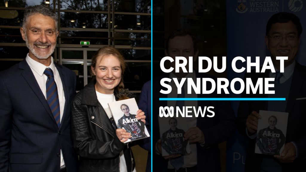 WA Finance Minister opens up about daughter's life with Cri du Chat ...