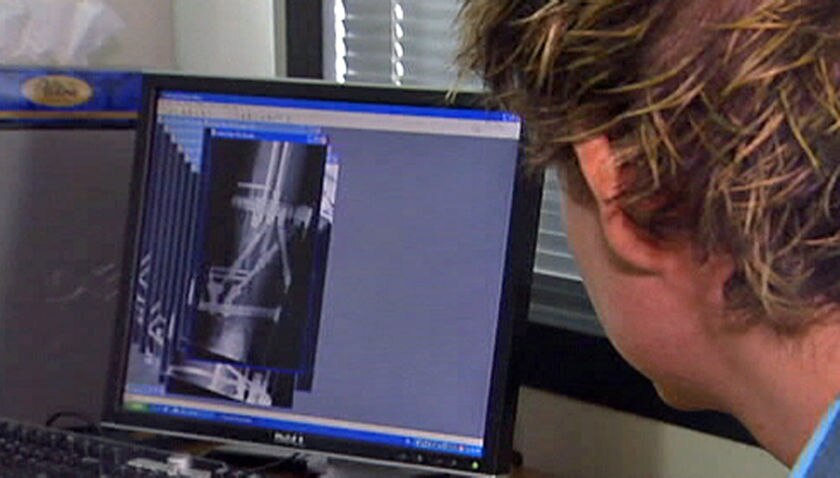 Crippled man grows bone, walks again - ABC News