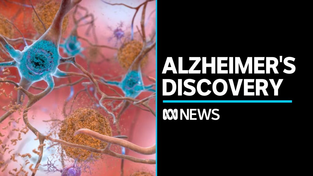 Brain cell discovery bring Alzheimer's blood test one step closer - ABC ...