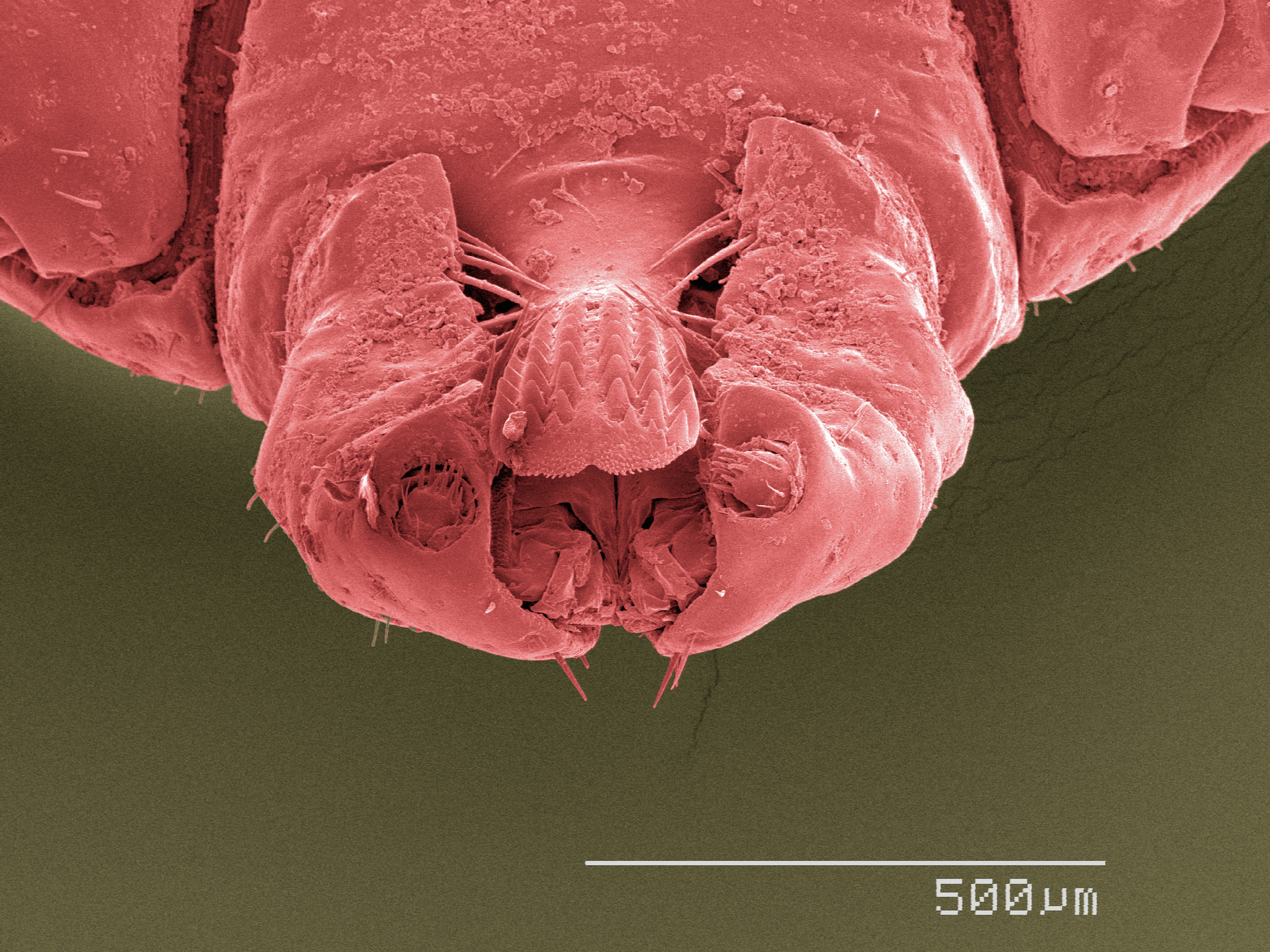 Brain amoeba, weird worms and the wild parasites (inside you too!) with ...