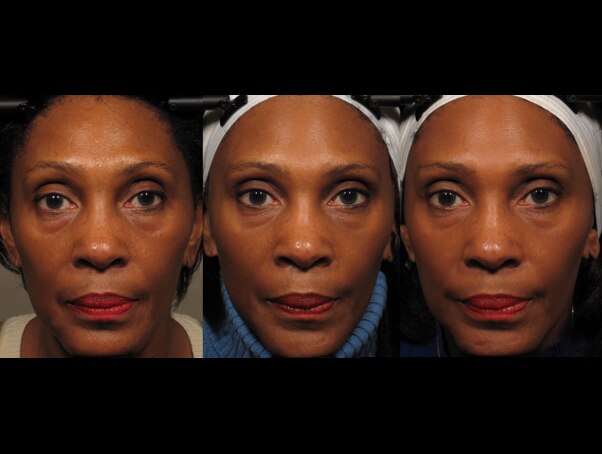 'Face yoga' just might reduce signs of ageing. Here's how it works ...