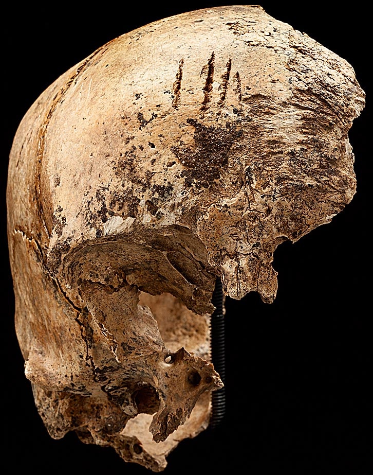Skull proves settlers resorted to cannibalism - ABC News
