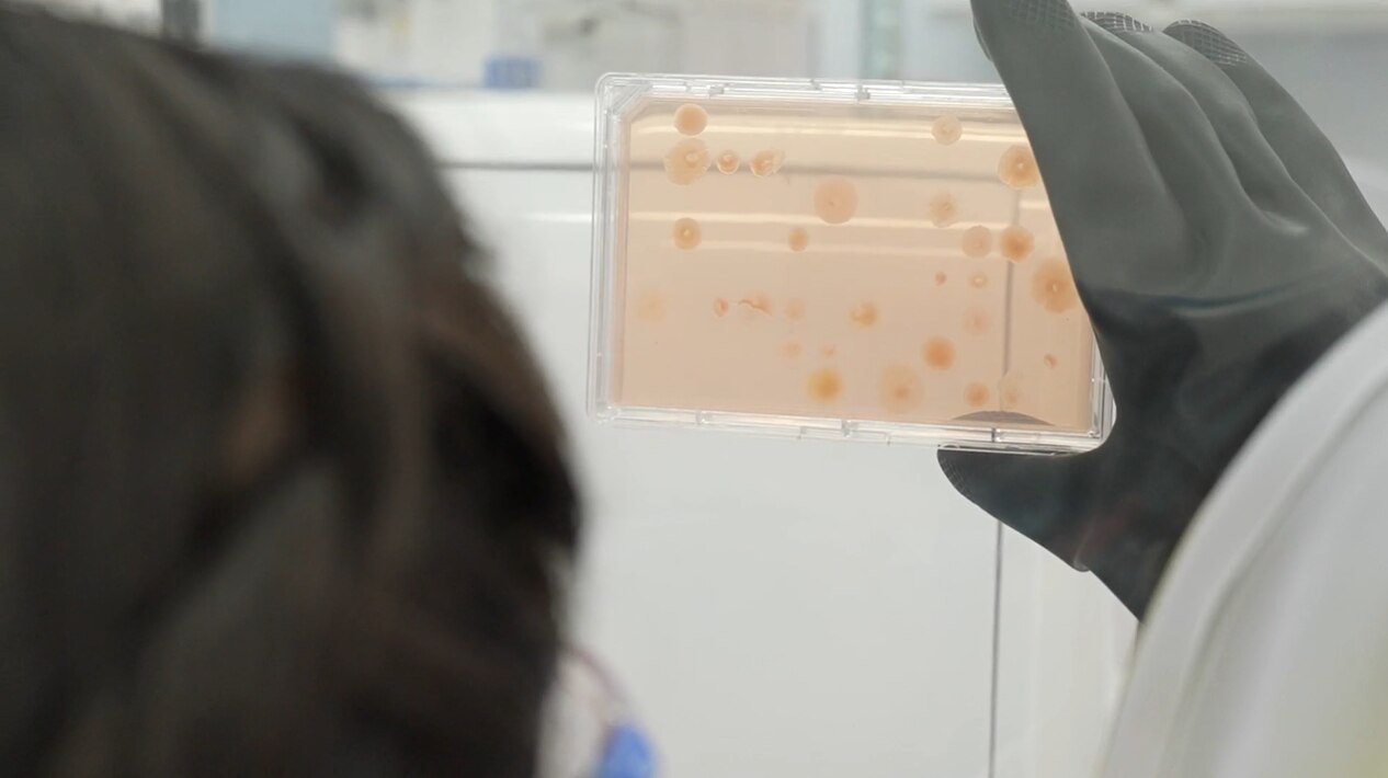 Would you donate your bacteria? Researchers say it could help pioneer ...