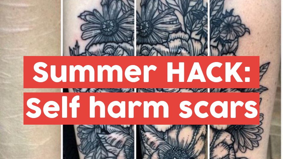 Summer Hack: Tattooing over self-harm scars - triple j