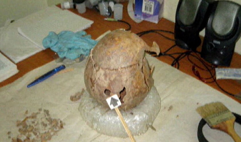 Unearthed E Timor bodies 'victims of military murder' - ABC News