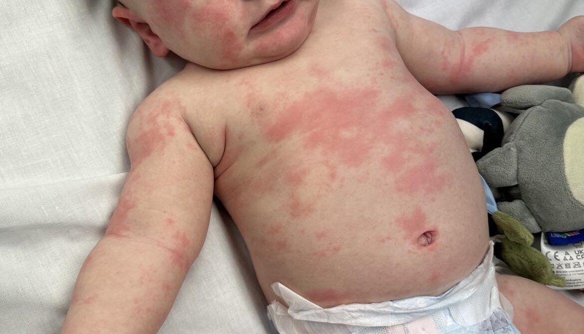 You should be giving these foods to your babies early to reduce their ...