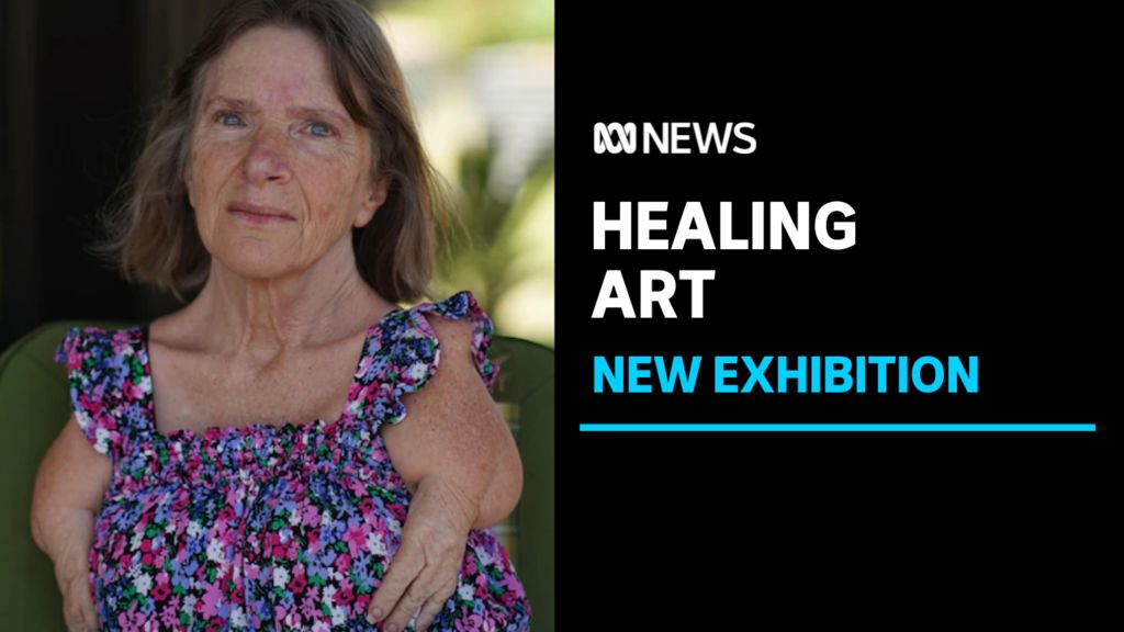Thalidomide survivor shines light on healing powers of art - ABC News