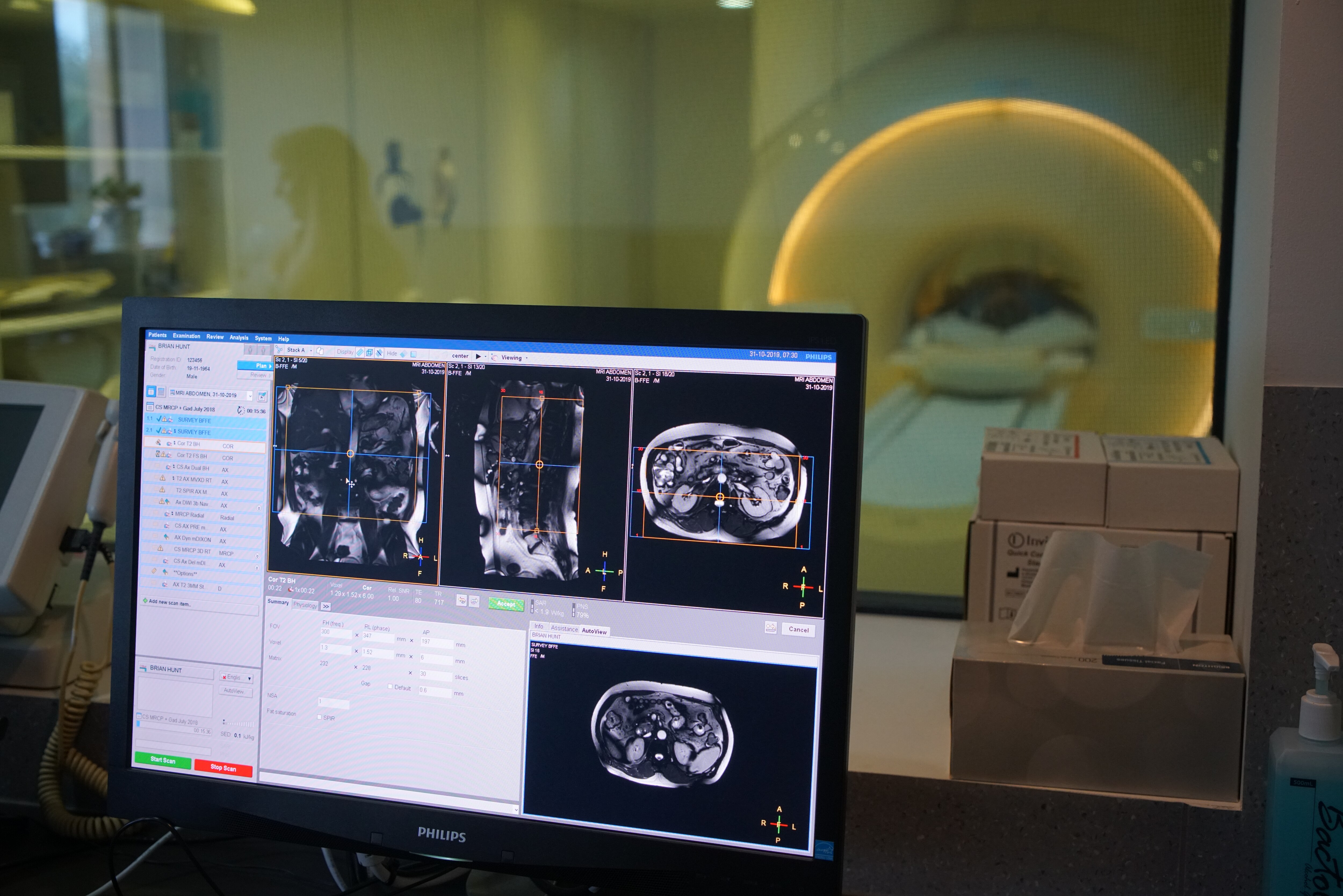 MRI scans causing anxiety, claustrophobia as access to new machines ...