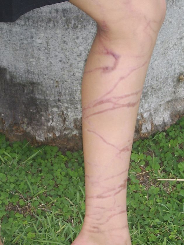 Box jellyfish warning as people stung at beaches - ABC News