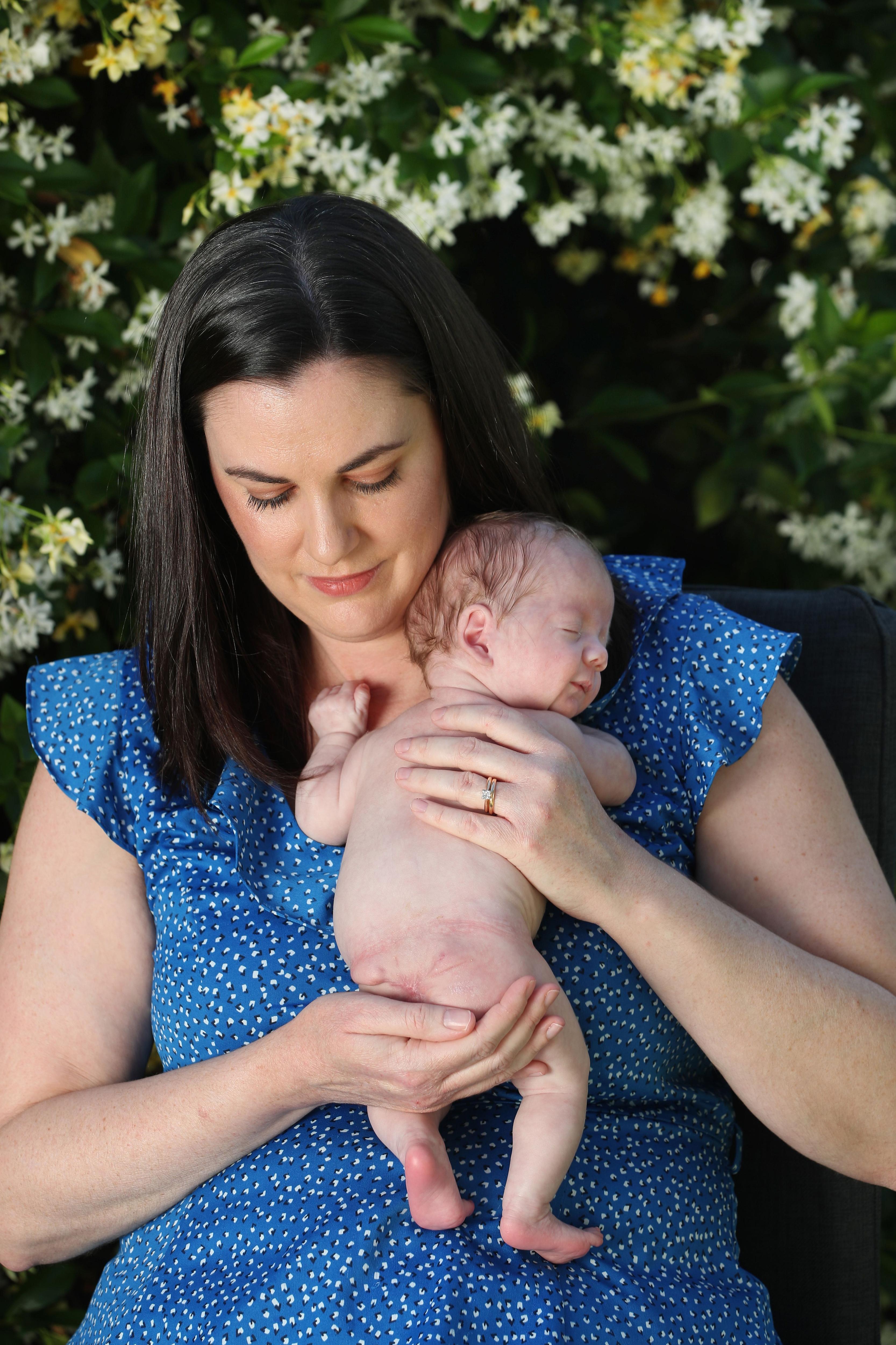 Brisbane baby Saylor Thomson was born 11 weeks early with a rare 2kg ...