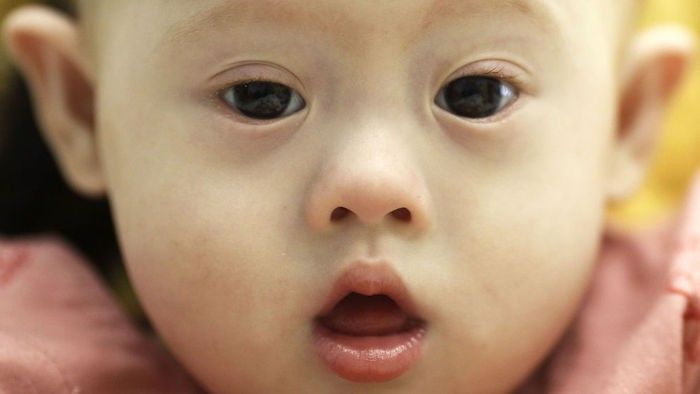 The Contradictions of Baby Gammy: Disability, Discrimination and the ...