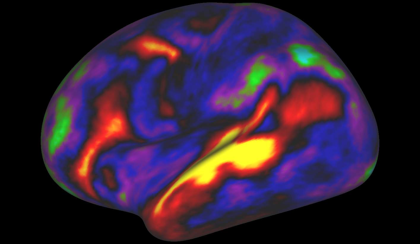 New multi-coloured brain map is 'most accurate yet' - ABC News
