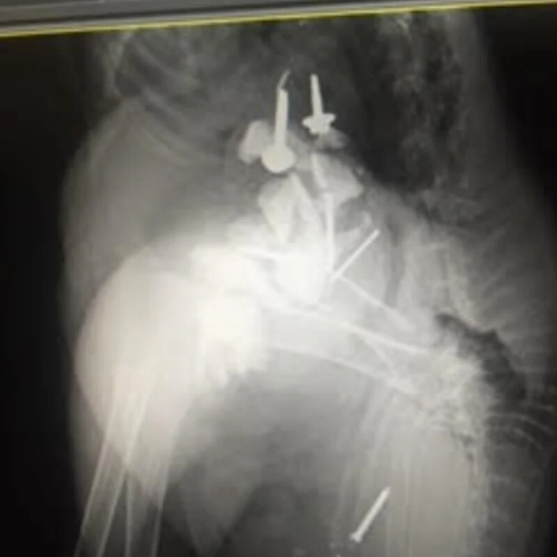 Emu found wandering Brisbane street almost dies in emergency surgery ...