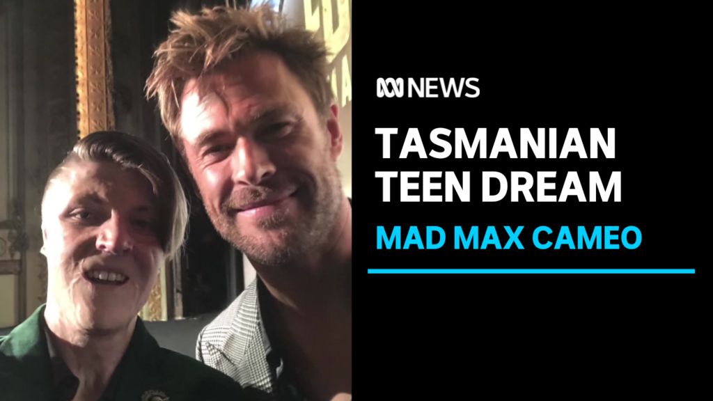 Burns survivor teen lands role in Mad Max prequel - ABC News