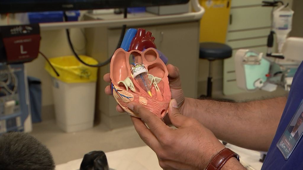 Dr Nikhil Pal explains the TAVI procedure - ABC News