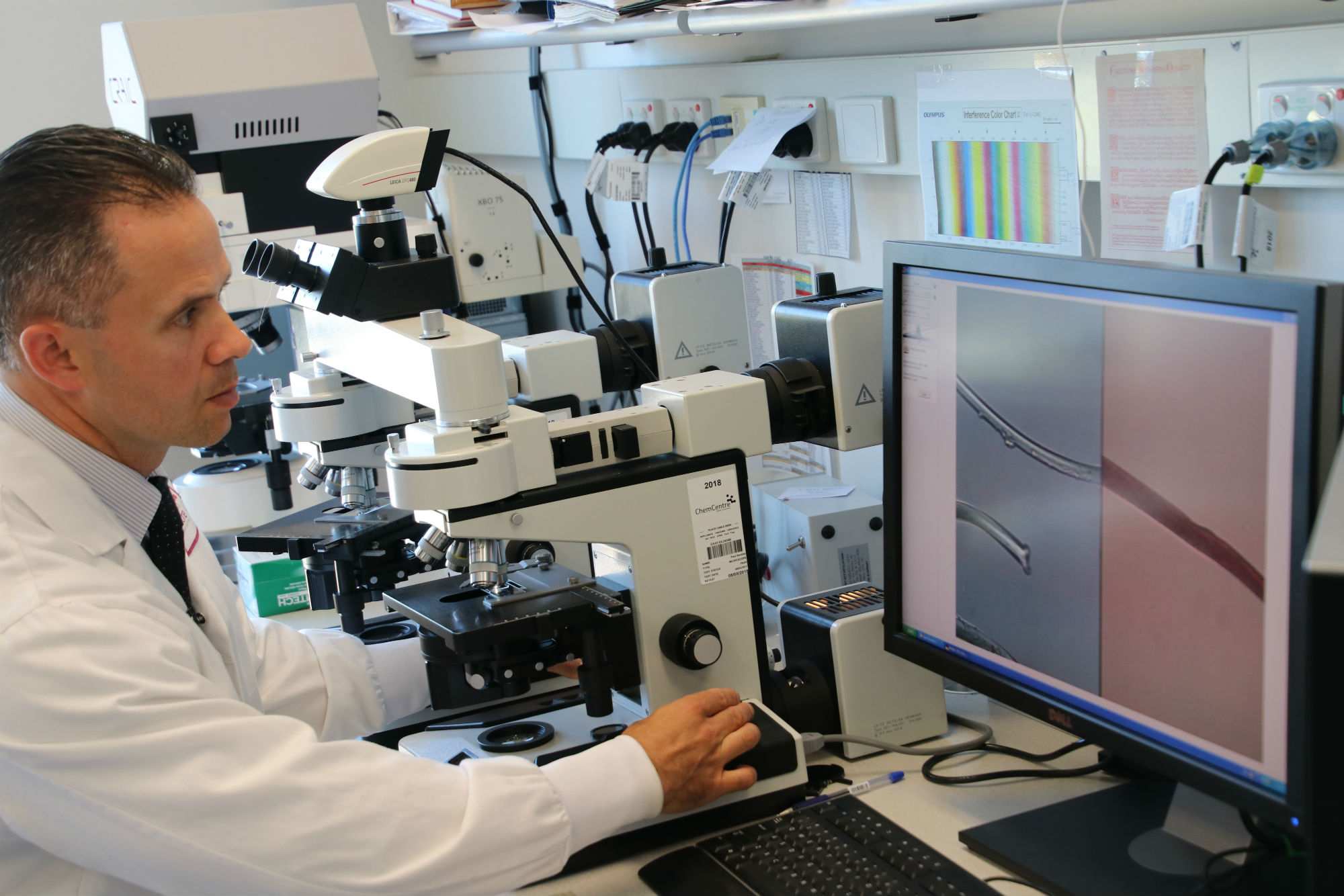 CSI by sticky tape: The forensic scientists unlocking murder mysteries ...