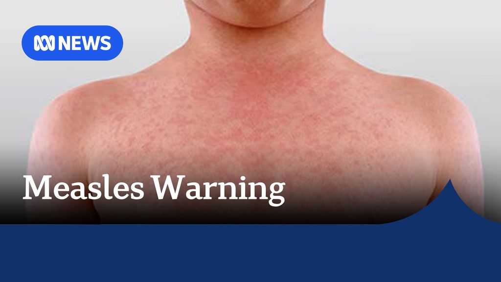 Alert over measles cases amid declining vaccination rates - ABC News