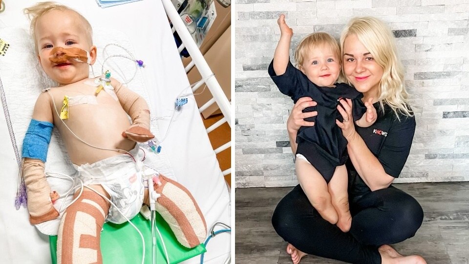 Japan is dealing with a 'flesh-eating bacteria' outbreak. Here's what ...