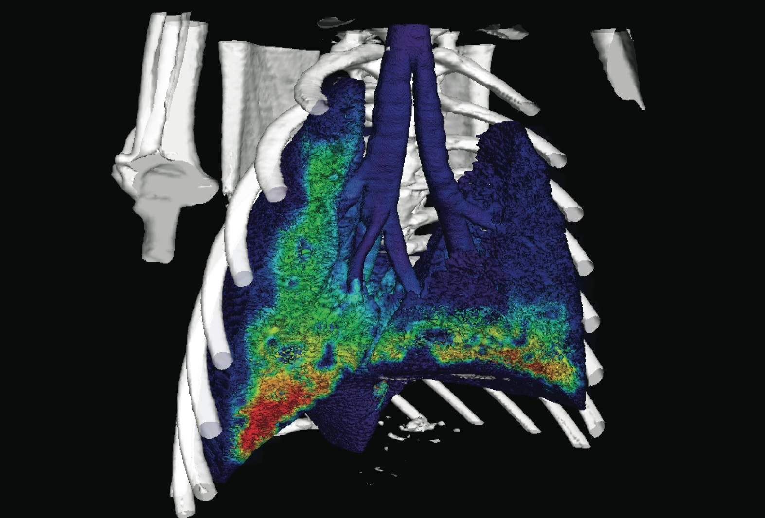 New imaging technology captures movement in the lung - ABC Radio National