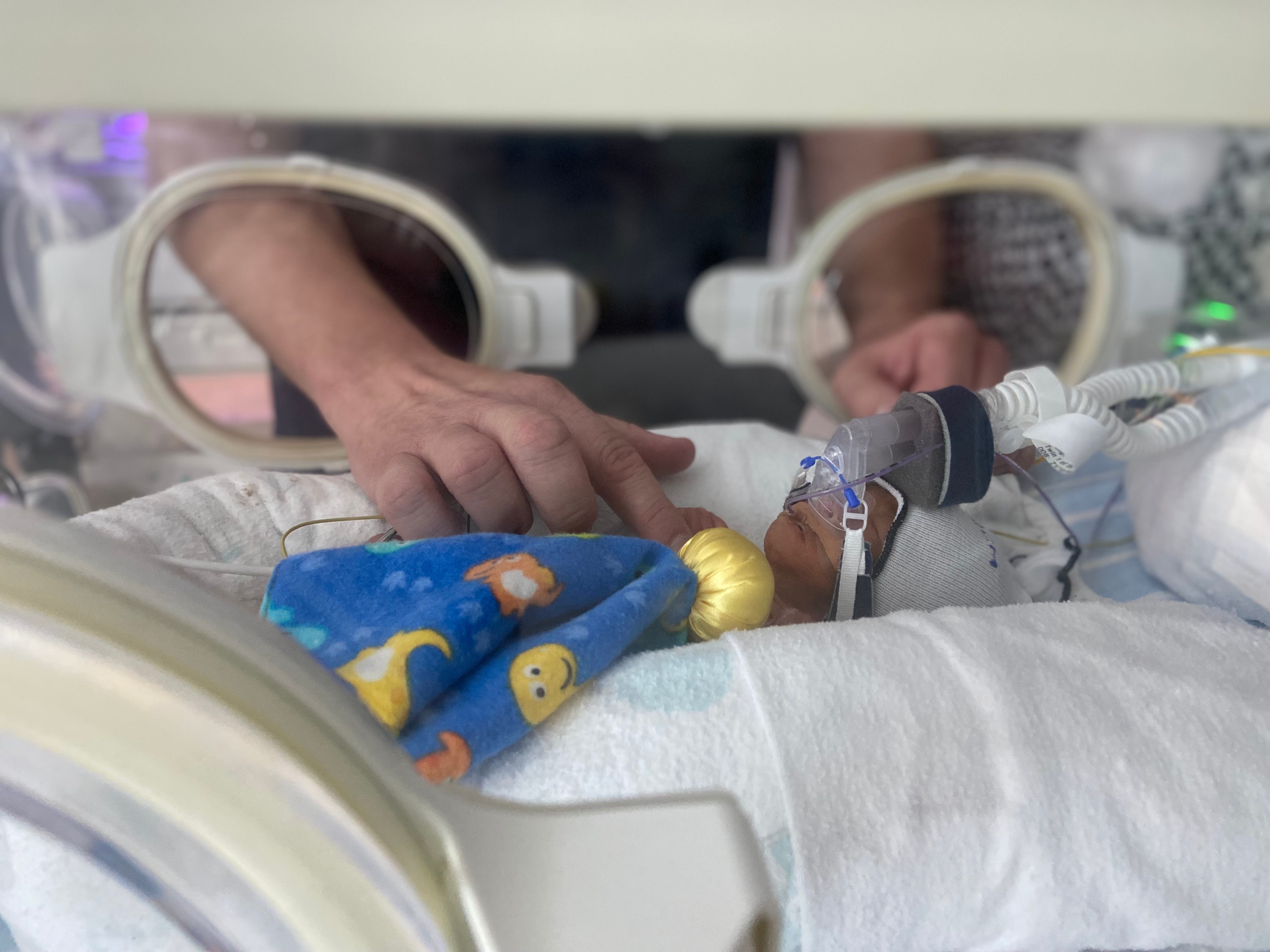 After necrotising enterocolitis ended baby Charlie's life, his parents ...