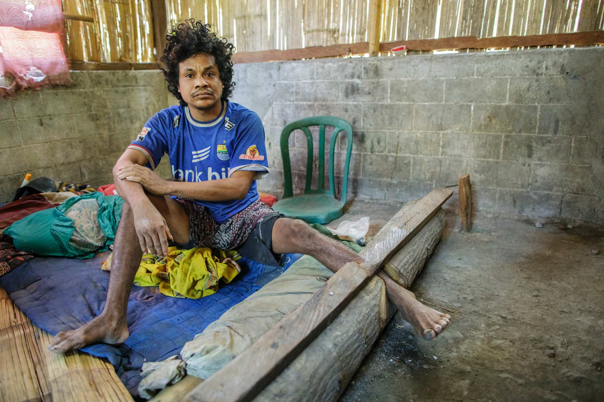 Hundreds of thousands of people shackled for mental health issues ...