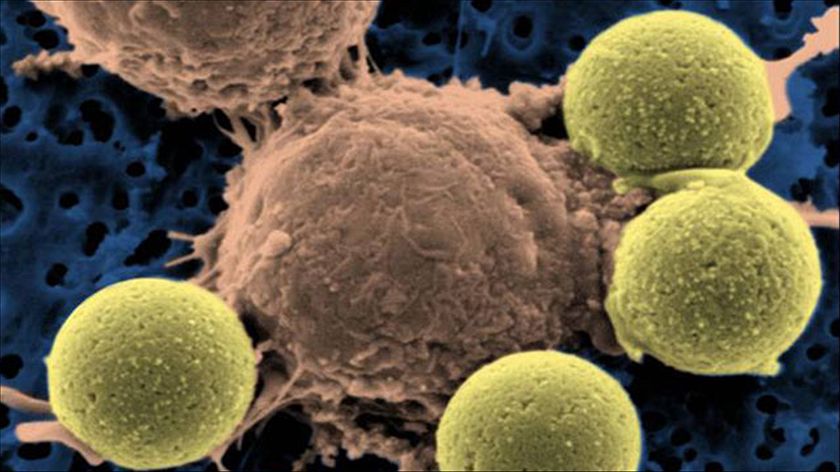 Research team finds peacekeeper cells that protect friendly bacteria ...