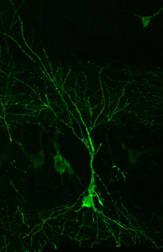 Tracking the development of nerve cells within the fetal brain - ABC listen