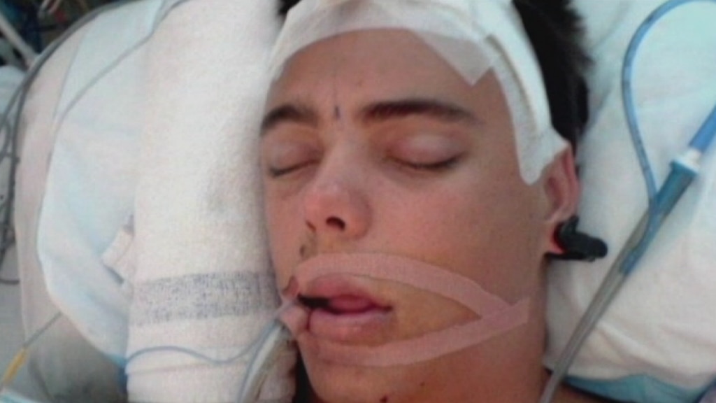 Queensland lockout laws will not curb violence, mother of one-punch ...