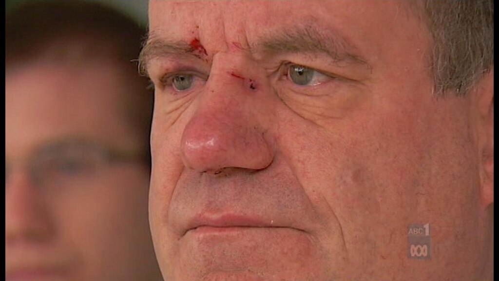 Foley takes time out after assault - ABC News